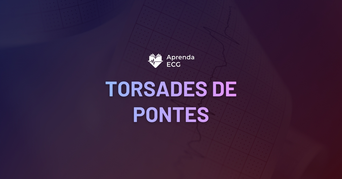 Torsades de Pointes - Aprenda ECG | Doctor Quest