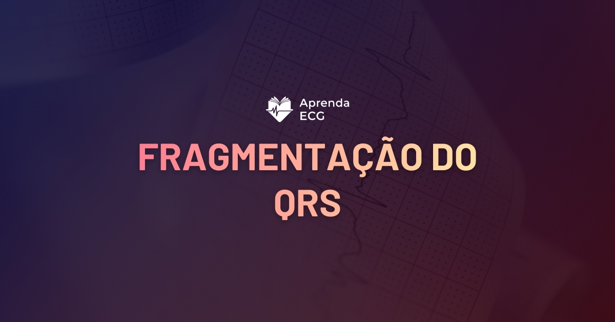 Fragmentação do QRS - Aprenda ECG | Doctor Quest