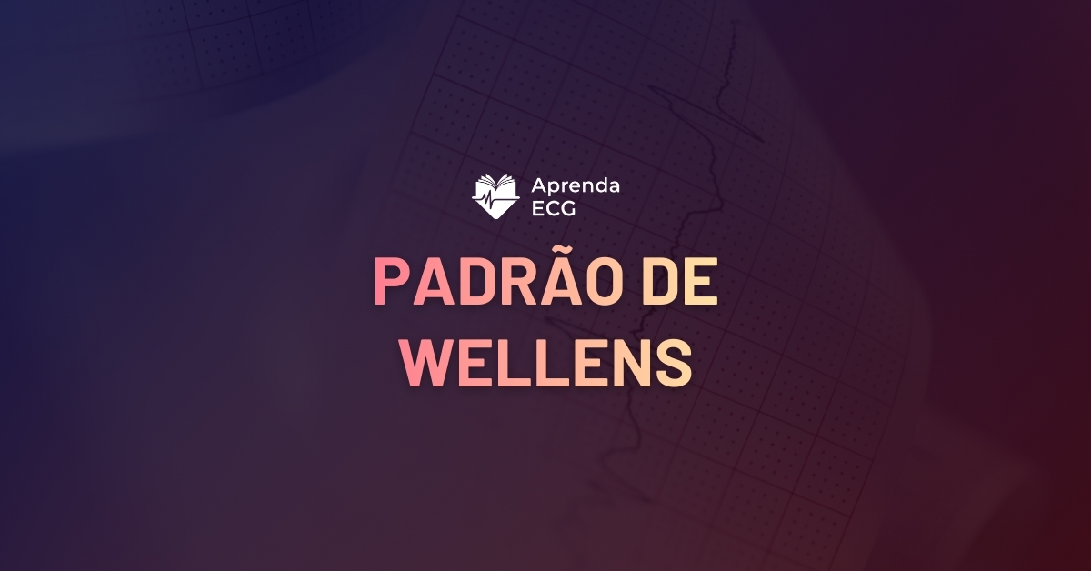 Síndrome de Wellens - Aprenda ECG | Doctor Quest