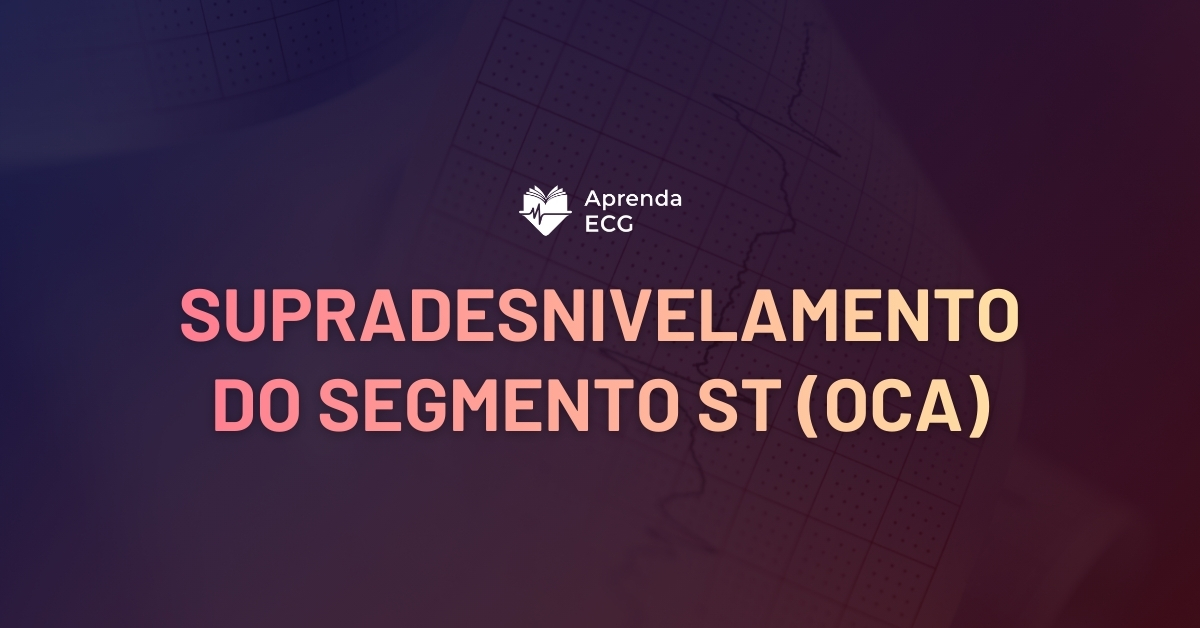 Supradesnivelamento do Segmento ST - Aprenda ECG | Doctor Quest
